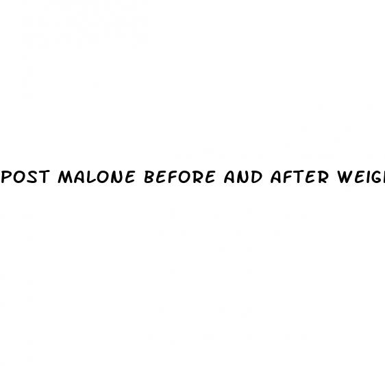 Post Malone Before And After Weight Loss - ﻿Cultura Y Desarrollo